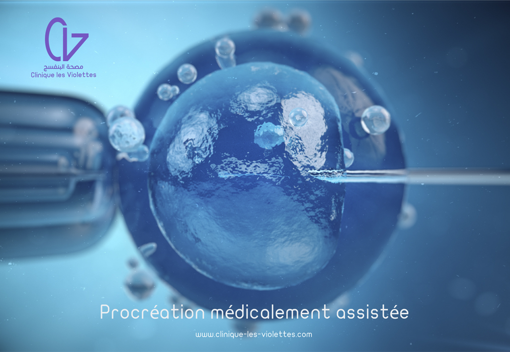Procréation médicalement assistée | Clinique les violettes